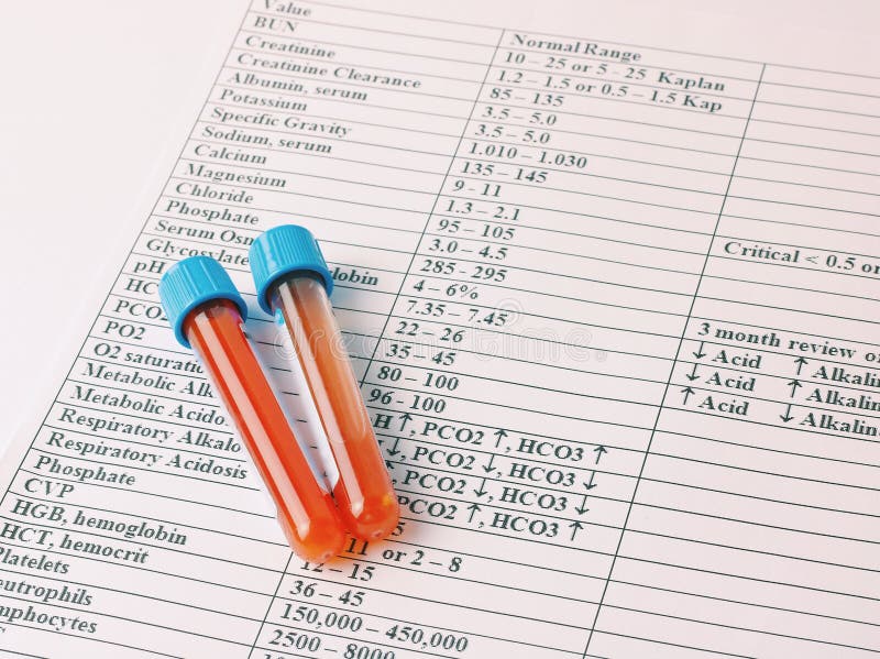 Hematology Test. Technician In Hematology Lab Testing Blood Sample In ...
