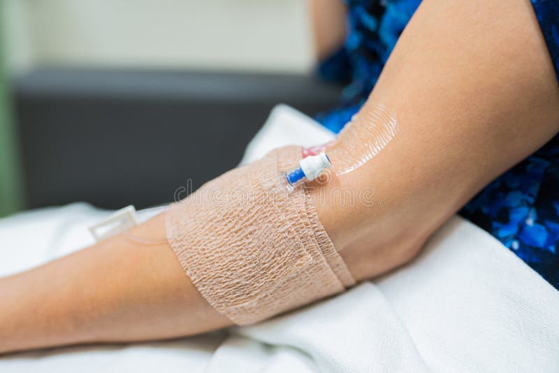 Inyectado en el brazo imagen de archivo. Imagen de droga - 55971429