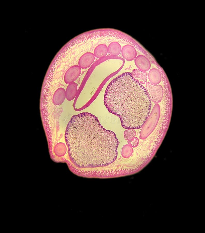 Histología Del Yeyuno, Micrográfo Imagen de archivo - Imagen de fondo ...
