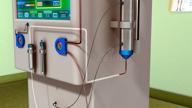 Hemodialyse stock fotografie