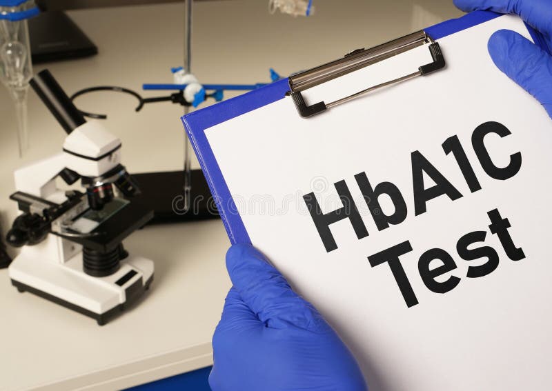 Hemoglobin A1C HbA1c Test is Shown Using the Text Stock Photo - Image ...