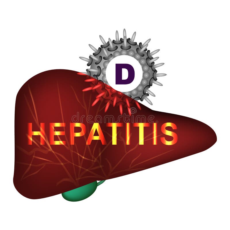 Hepatitis D Stock Illustrations – 229 Hepatitis D Stock Illustrations ...