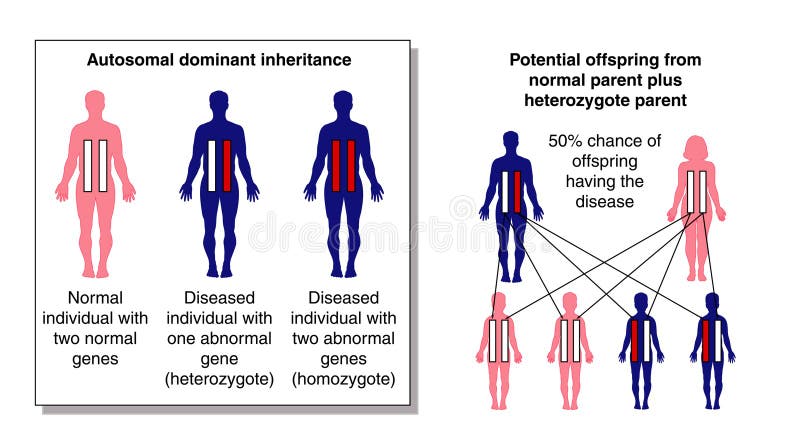 Recesivo Dominante O De Un Autosoma De Un Autosoma Ilustración del ...