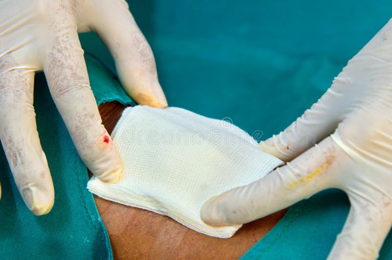 Herida del apósito de gasa foto de archivo. Imagen de antiséptico ...