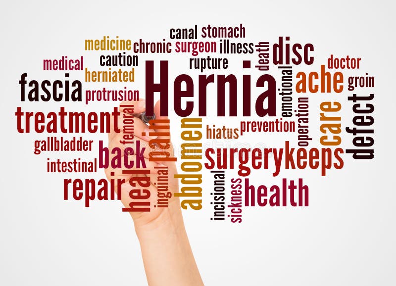 Hernia Symbol Stock Illustrations – 219 Hernia Symbol Stock ...