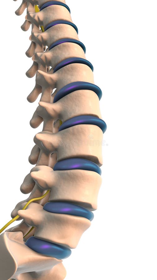 Slipped Disk or a Ruptured Disk Stock Illustration - Illustration of ...
