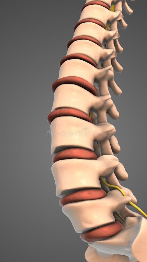 Herniated Disc in Lumbar Vertebrae Stock Illustration - Illustration of ...