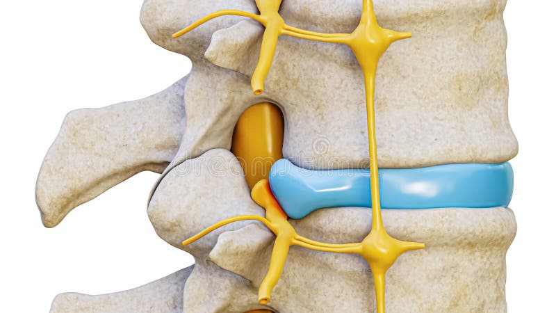 X-ray Spinal Column with Scoliosis, Lordosis and Kyphosis Postures ...