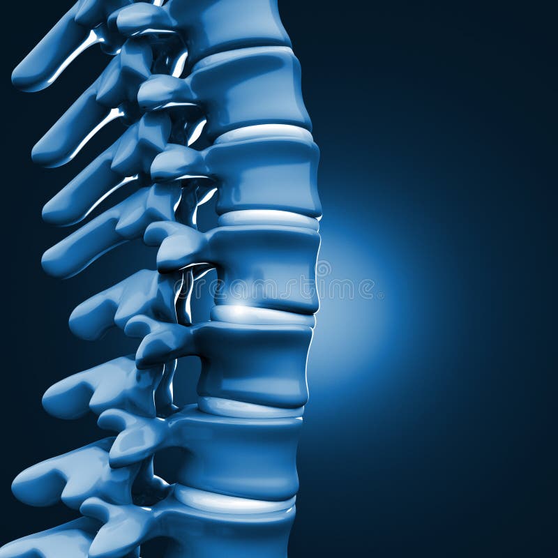 Herniated Schijf Menselijke Ruggegraats Stock Illustratie ...