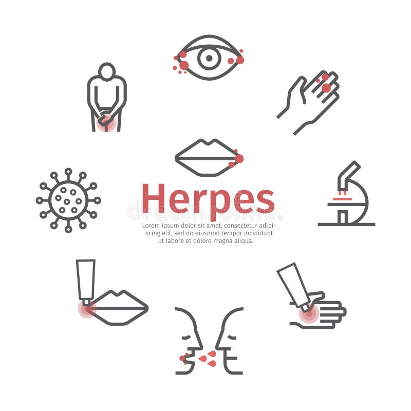 Herpes. Symptoms, Treatment. Flat Icons Set Stock Vector - Illustration ... Herpes. Symptoms, Treatment. Flat Icons Set Stock Vector - Illustration ...