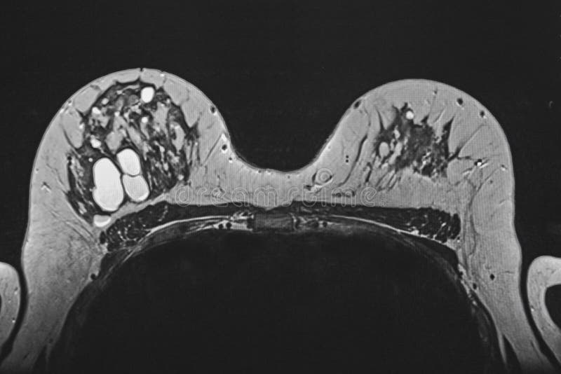 Närbild av fotografering för bildbyråer. Bild av stängning - 65436351