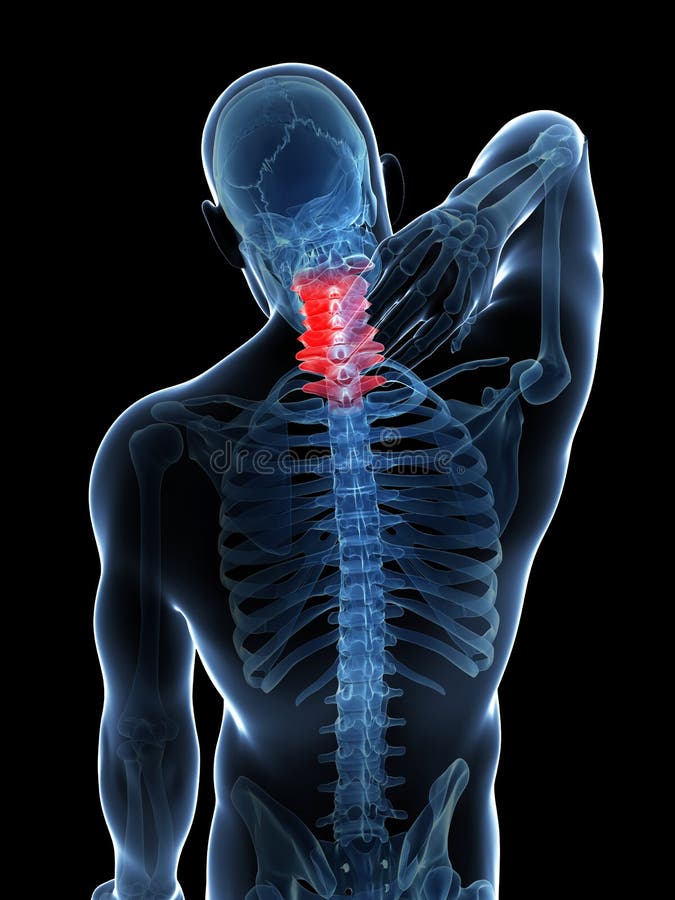 Hervorgehobener Hals stock abbildung. Illustration von strahl - 30722173