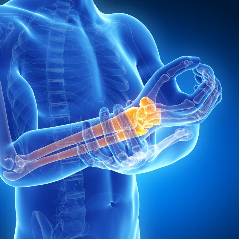 Handgelenkgelenk stock abbildung. Illustration von medizinisch - 45342652