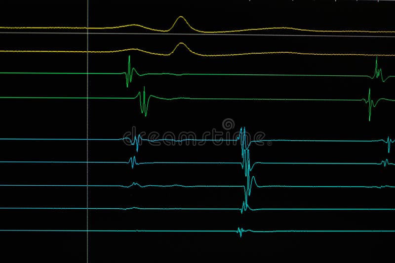 2,807 Kardiograph Fotos - Kostenlose und Royalty-Free Stock-Fotos von ...