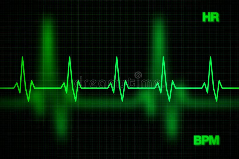 Herz Mit Diagramm Und Herzfrequenz Vektor Abbildung - Illustration von ...
