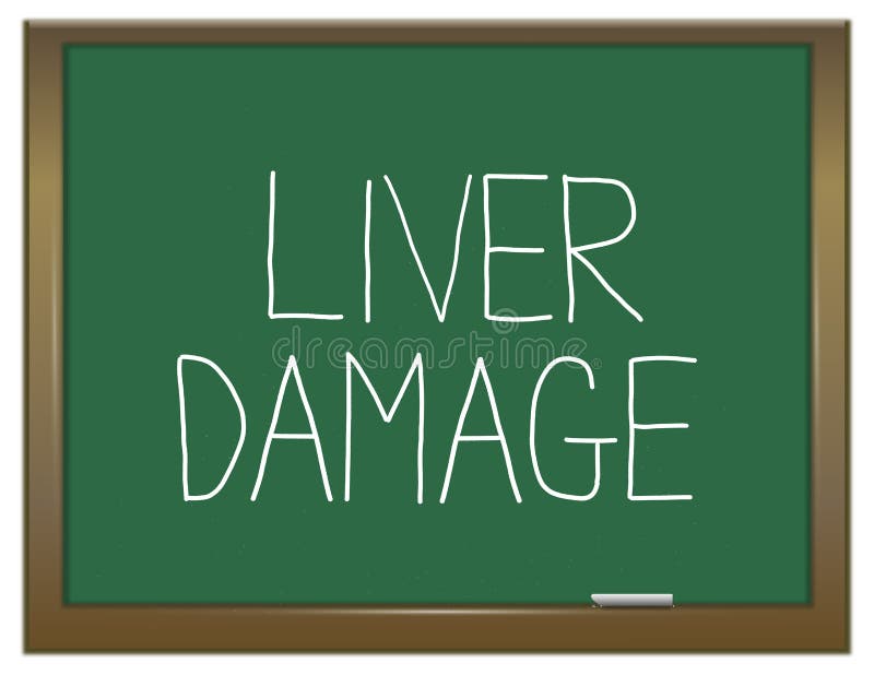 Schade Stock Illustrations, Vectors, & Clipart – (142,178 Stock ...