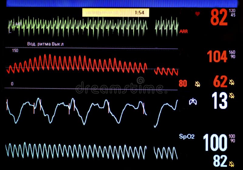 Het De Monitorscherm Van Het Hart Stock Illustratie - Illustration of ...