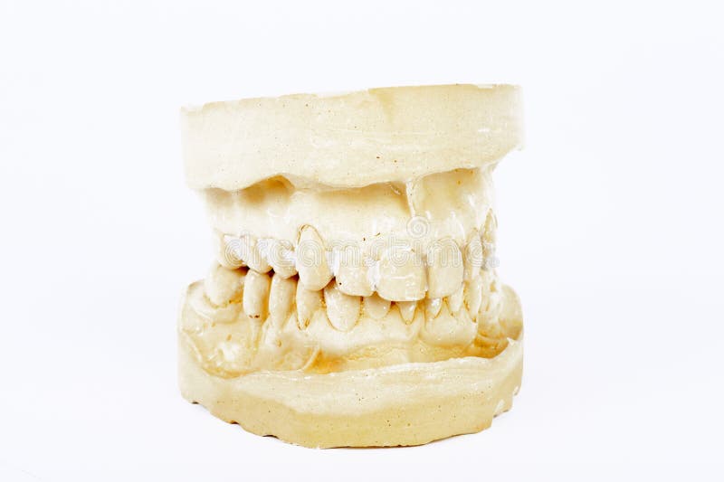 Gipsmodel Van Kaak Met Tanden Binnen in De Handen Van Een Tandarts ...