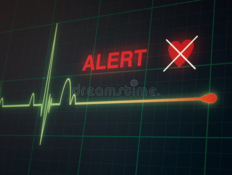 Het Hart Slaat Cardiogram Op De Monitor Stock Foto - Image of grafiek ...