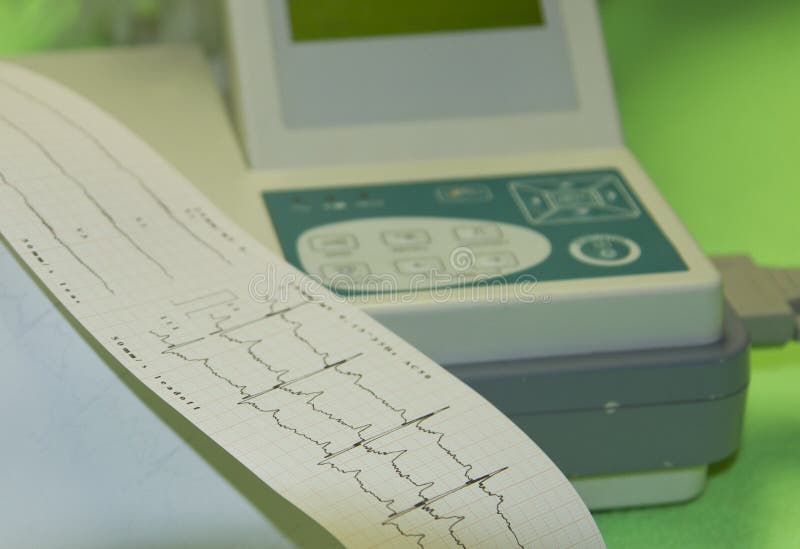 Het hart sloeg monitor stock afbeelding. Image of lijn - 33062377