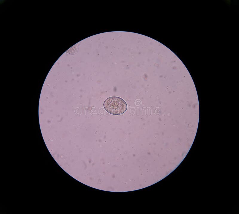 Het Lint is Een Soort Lintworm (een Type Van Worm) Stock Afbeelding ...