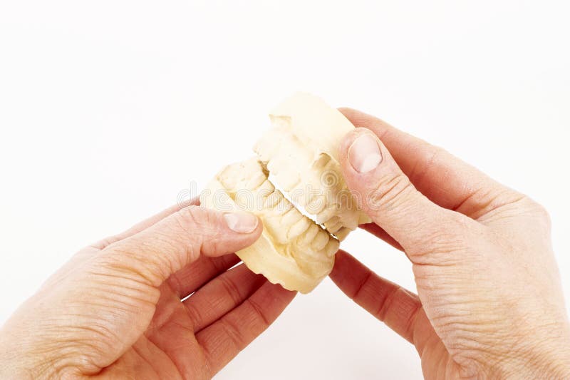 Het Model Van Het Gips Voor Gebit Stock Foto - Image of gezondheid ...