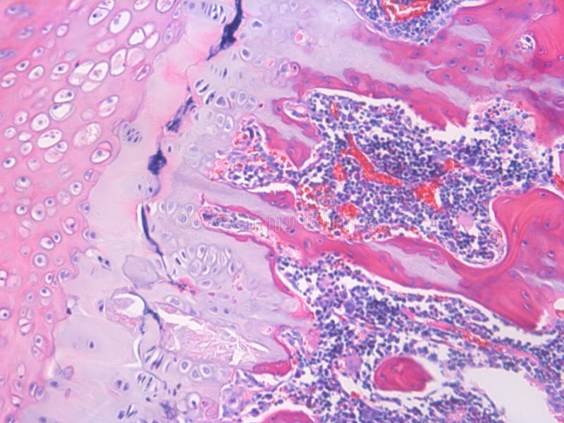 Het Weefsel Van Het Ruggegraatbeen Stock Afbeelding - Image of been ...