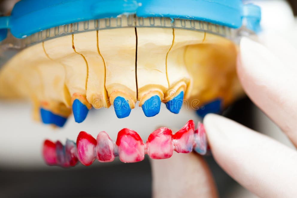 Het Werk Van De Tandtechnicus Stock Foto - Image of tandheelkunde ...