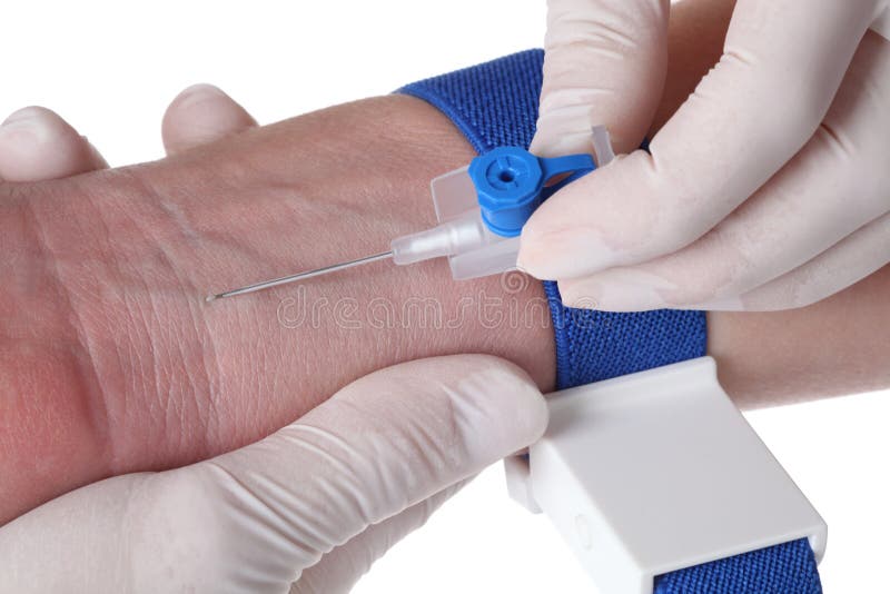 Het Zetten Van Intraveneuze Cannula Stock Afbeelding - Image of medisch ...
