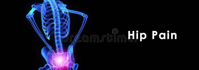 Heuppijn stock illustratie. Illustration of geneeskunde - 46412806