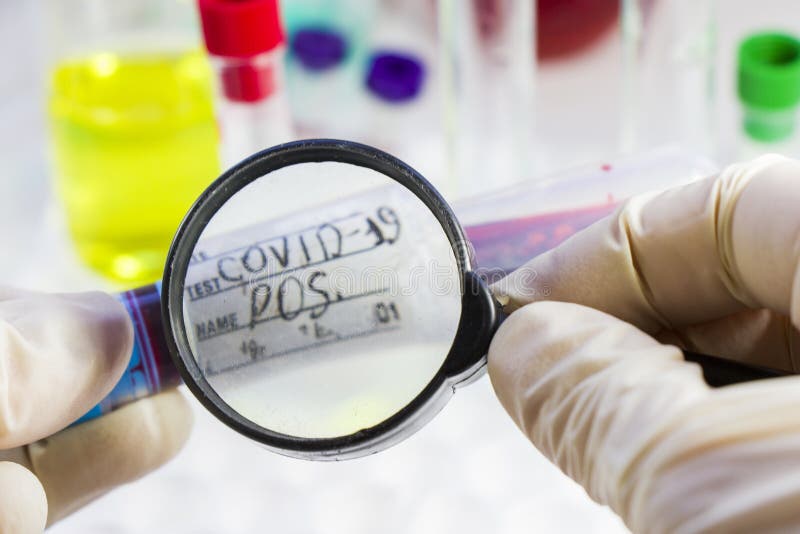 High Angle Shot of a Blood Sample Test with Positive Result Zoomed with ...