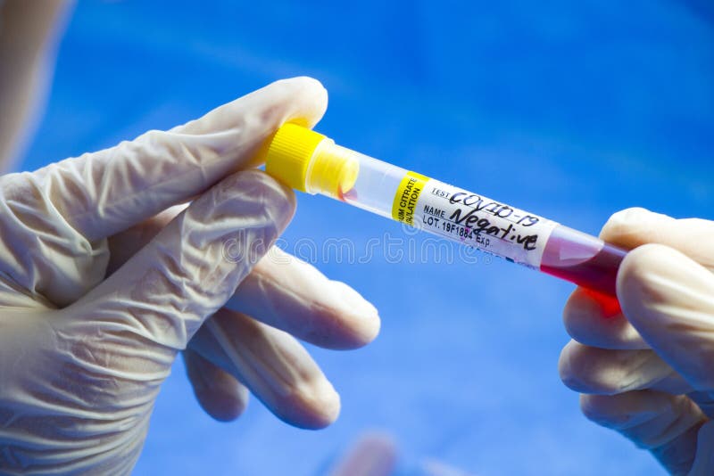 High Angle Shot of a Blood Test Sample with Negative Result in Doctor ...