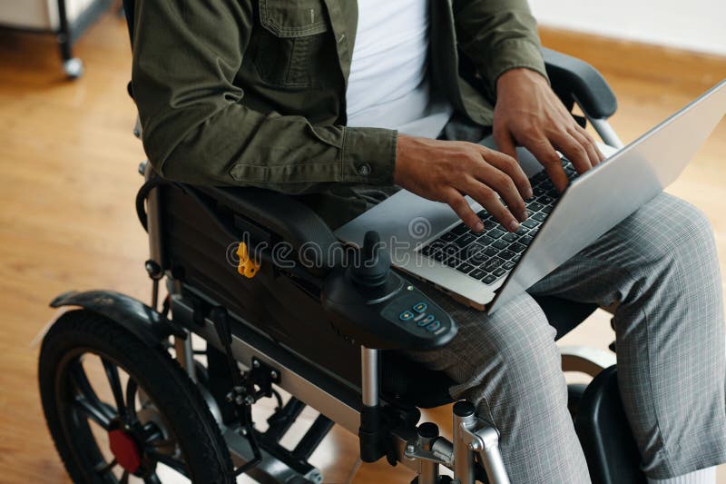 Office Worker with Disability Typing on Laptop Stock Image - Image of professional, closeup ...