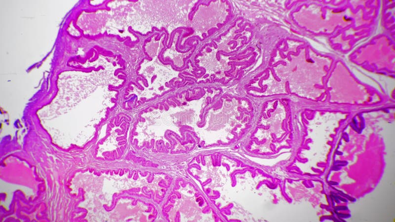 High Magnification 200x Of Section Of Human Duodenum Filmed Under Microscope On Bright Field