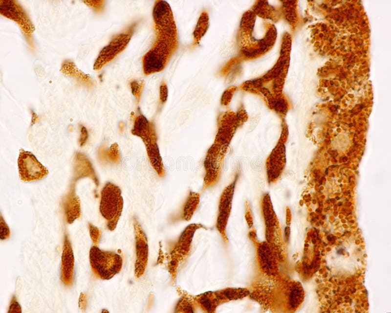 Iris Dilator Stock Photos - Free & Royalty-Free Stock Photos from ...