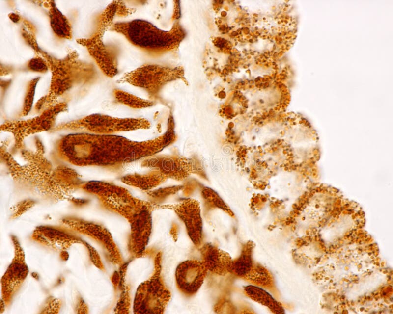 Eye. Iris melanin stock image. Image of micrograph, ocular - 303600661