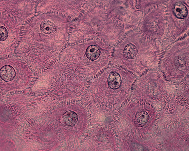 Epidermis. Spinous Cell Layer Stock Image - Image of histology ...