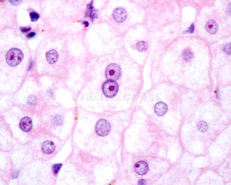 Human Hepatocyte. Nucleolus Stock Photo - Image of nucleolus ...