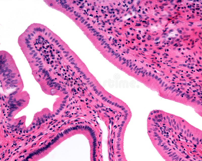 Ampulla Of Vater Histology