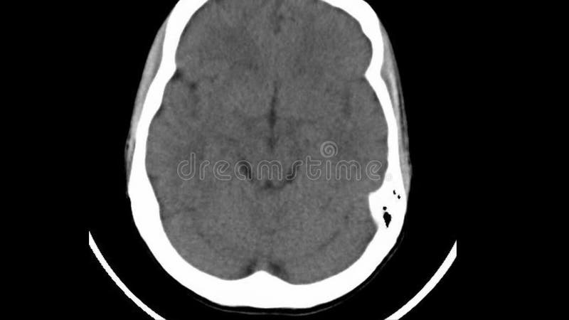 High-resolution MRI Scan Captures Detailed Cross-sectional Images of ...