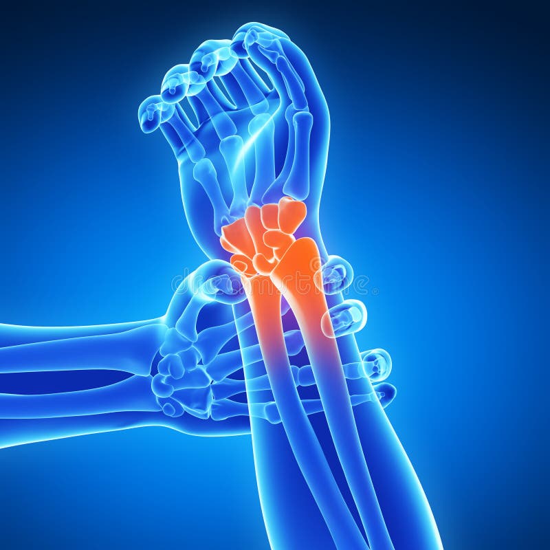 Highlighted arm stock illustration. Illustration of body - 30722390