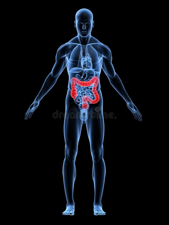 Highlighted colon stock illustration. Illustration of inflammation ... Highlighted colon stock illustration. Illustration of inflammation ...