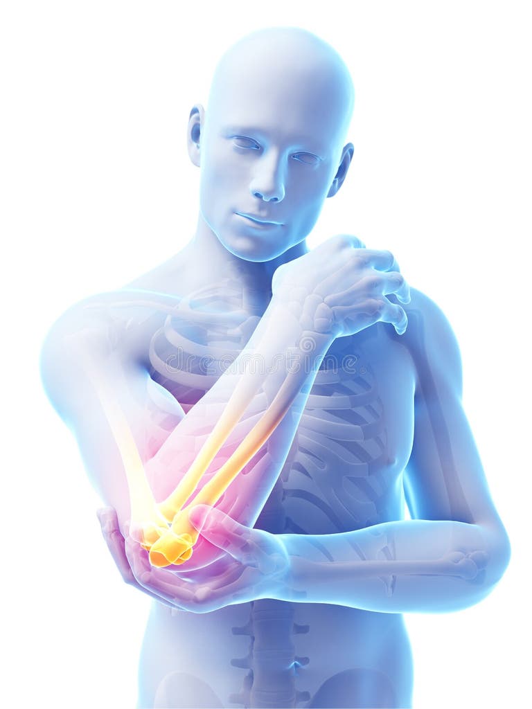 Elbow Pain Stock Illustrations – 5,237 Elbow Pain Stock Illustrations ...