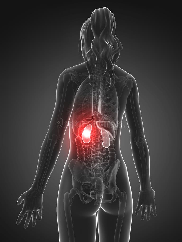 Kidney Failure Stock Illustrations – 2,245 Kidney Failure Stock ...