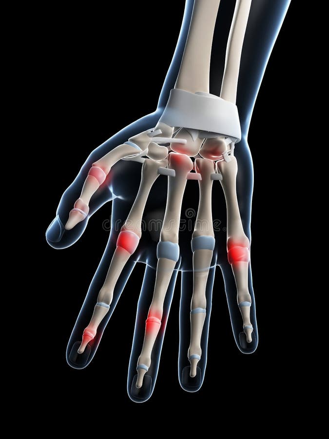 Highlighted finger joints stock illustration. Illustration of health ...