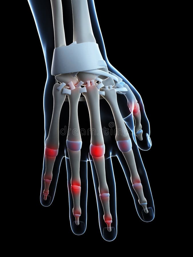 Highlighted finger joints stock illustration. Illustration of anatomy ...