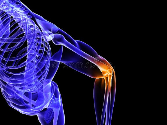 Highlighted human ellbow stock illustration. Illustration of inflamed ...