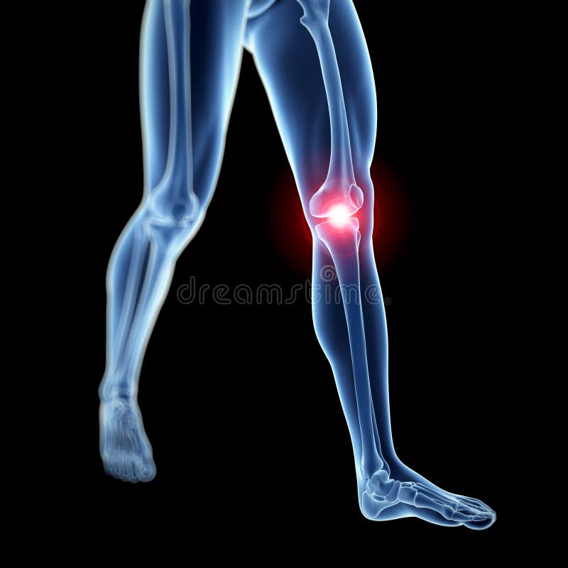 Highlighted arm stock illustration. Illustration of injury - 30722395