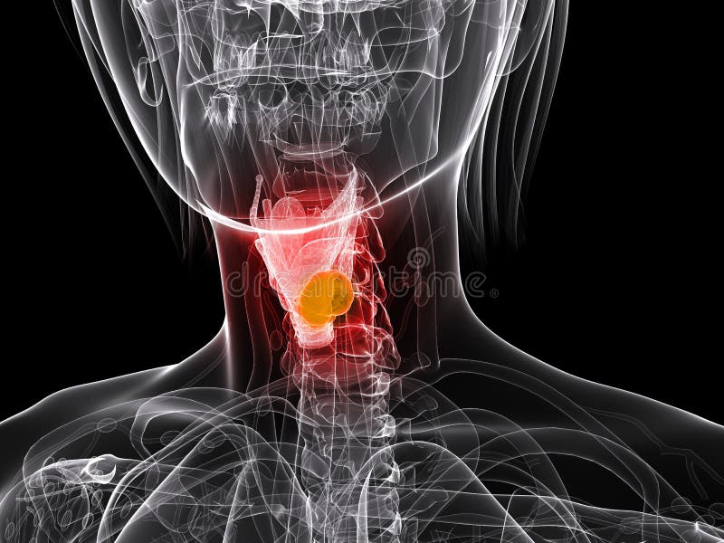 Highlighted larynx stock illustration. Illustration of disease - 14527338