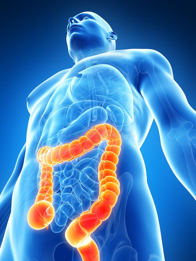 Colon Inflamed Stock Illustrations – 541 Colon Inflamed Stock ...